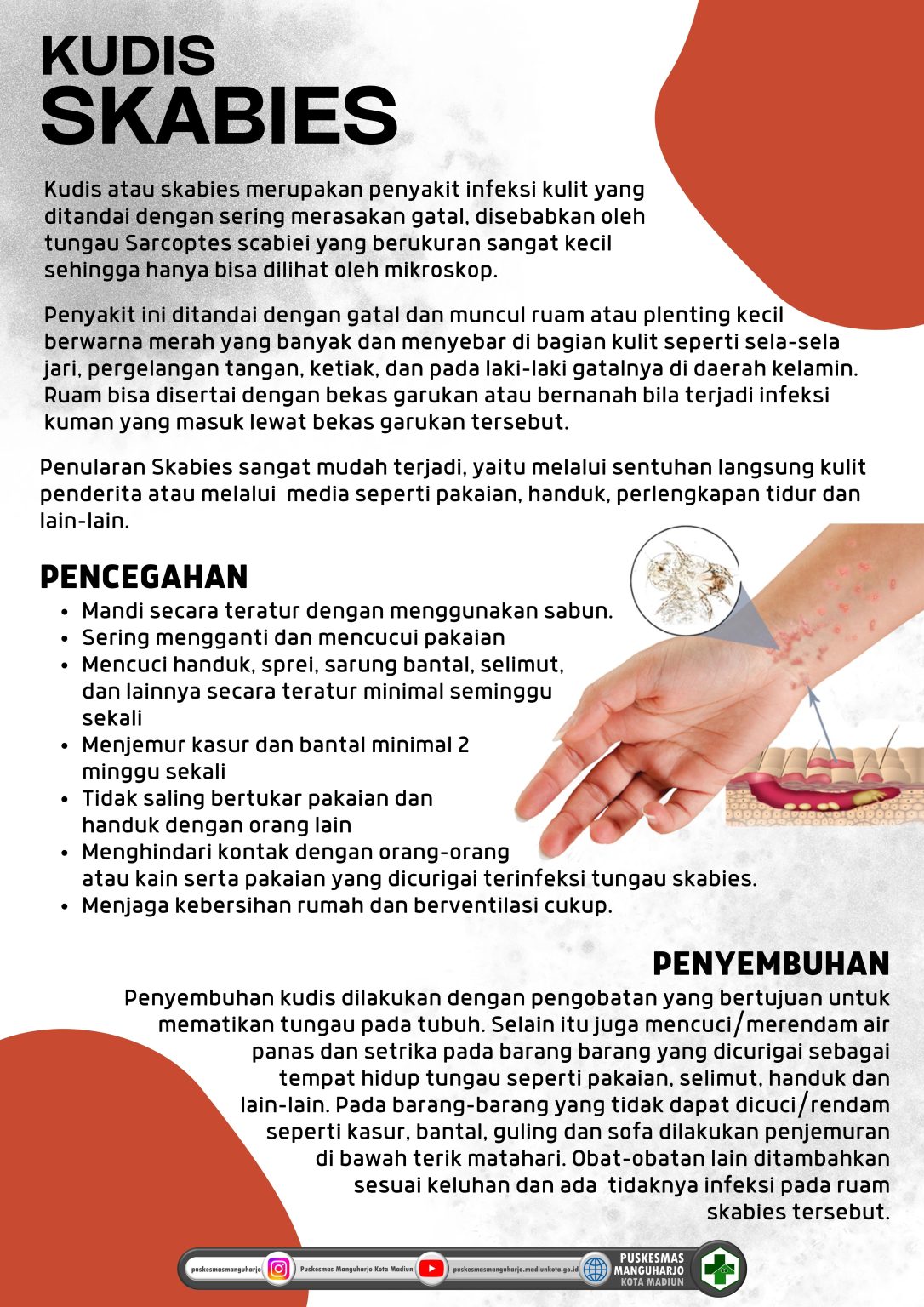 Apa itu Skabies? – UPTD PUSKESMAS MANGUHARJO
